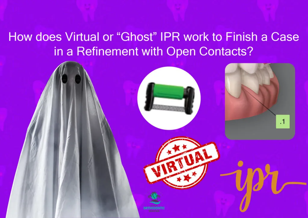 How Does Virtual or Ghost IPR Work to Close Loose Contacts in Invisalign?
