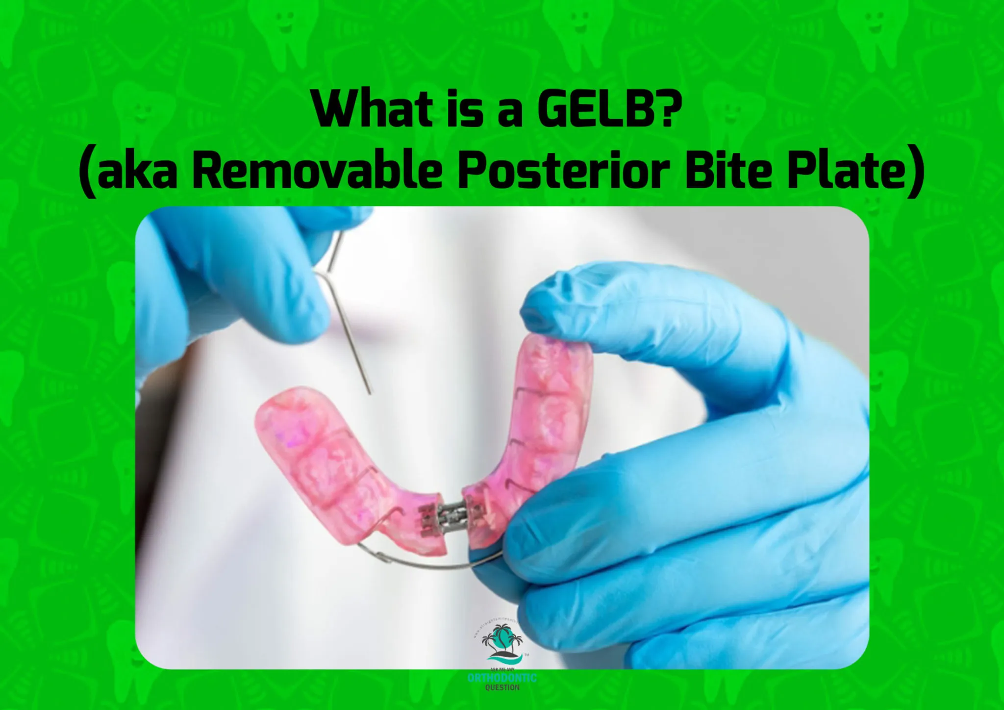 What You Need to Know About Removable Posterior Bite Plates (GELB)