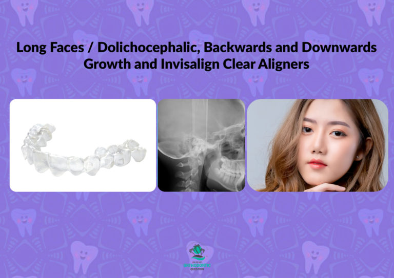 Long, Dolichocephalic Faces with Backwards and Downwards Growth and ...