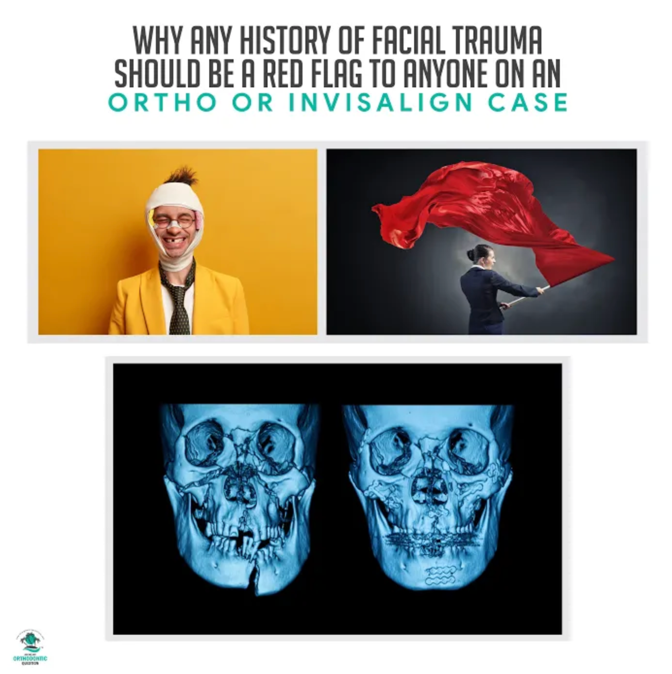 Why any History of Facial Trauma should be a red flag on an Ortho or ...