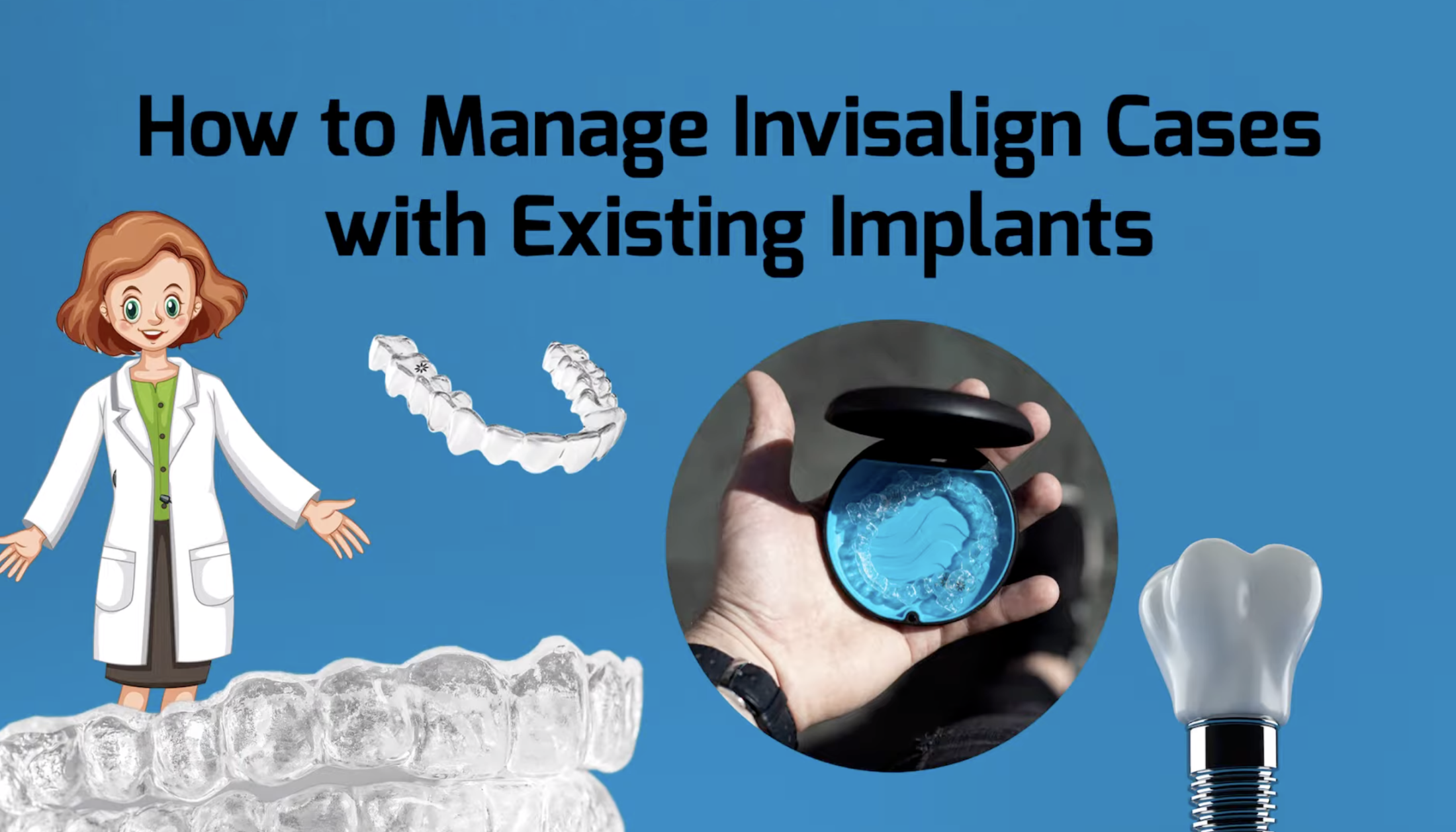 How to Manage an Invisalign Case with Existing Implants
