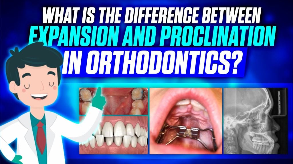 Expansion vs Proclination in Orthodontics Cases