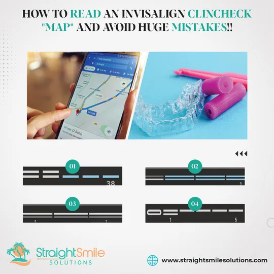 Learn to Read Invisalign ClinChecks Before Starting!