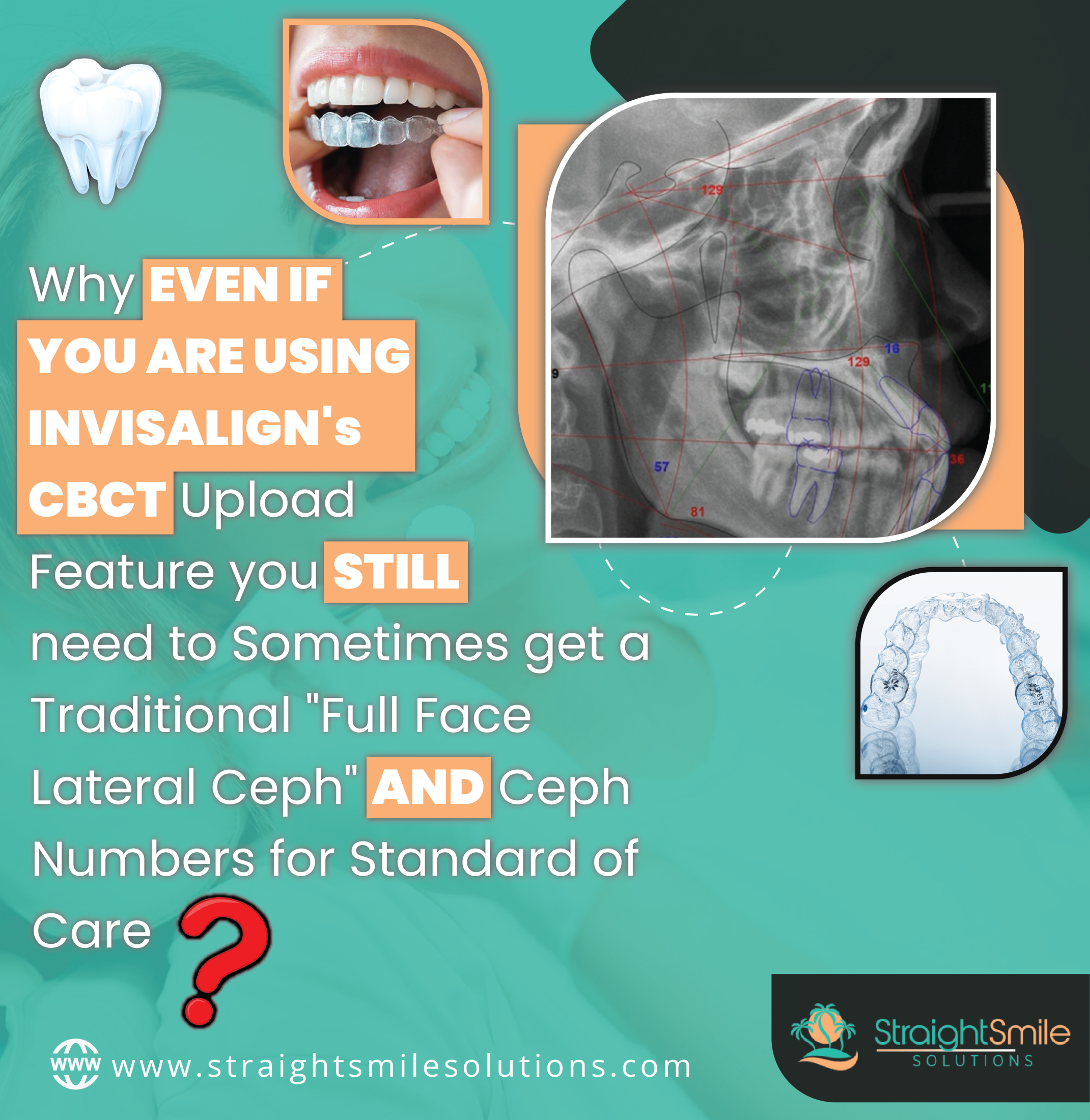 Do I Need a CEPH with Invisalign CBCT?