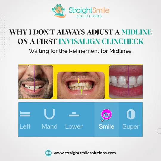 Why I Don't Normally Adjust Midlines on a First Invisalign Clincheck