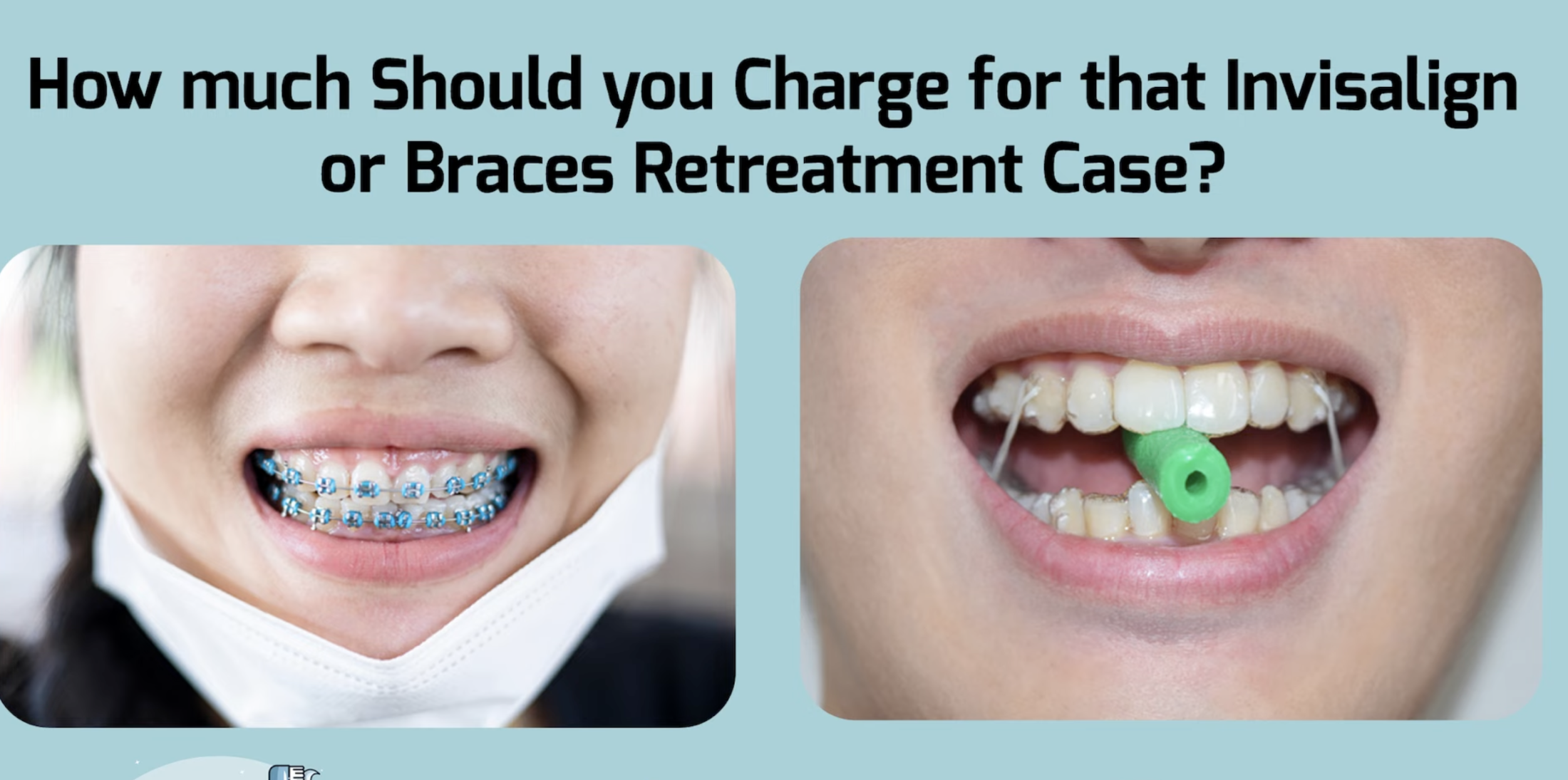 What Should you Charge for Braces or Invisalign Re-treatment Case, or ...