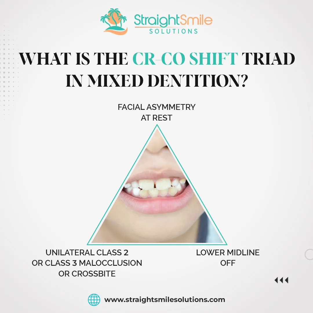 What is the CR-CO Shift Triad In Mixed Dentition Treatment Planning?