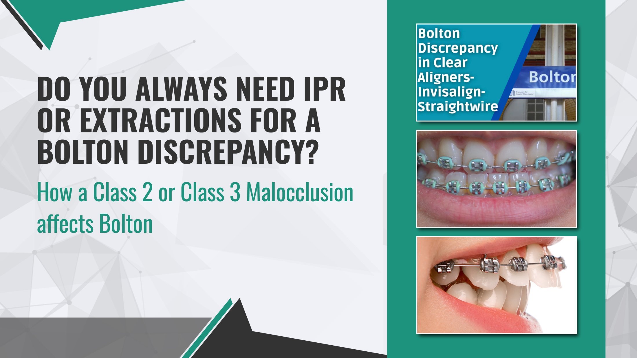 Bolton Discrepancy in Mild Class 2 and Class 3 Cases
