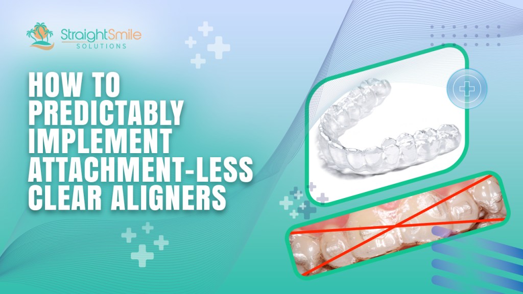 How to Predictably Implement Attachment-Less Clear Aligners