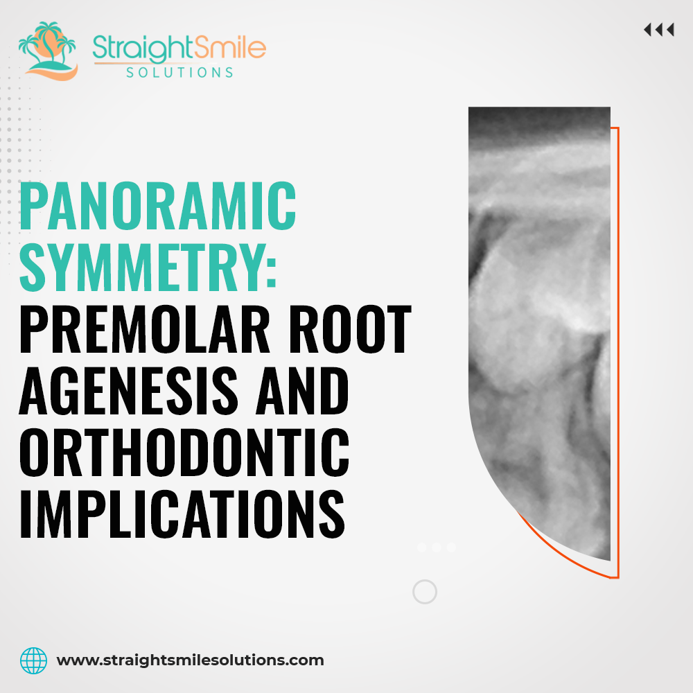 Orthodontics Treatment Plan Options for Premolar Root Agenesis