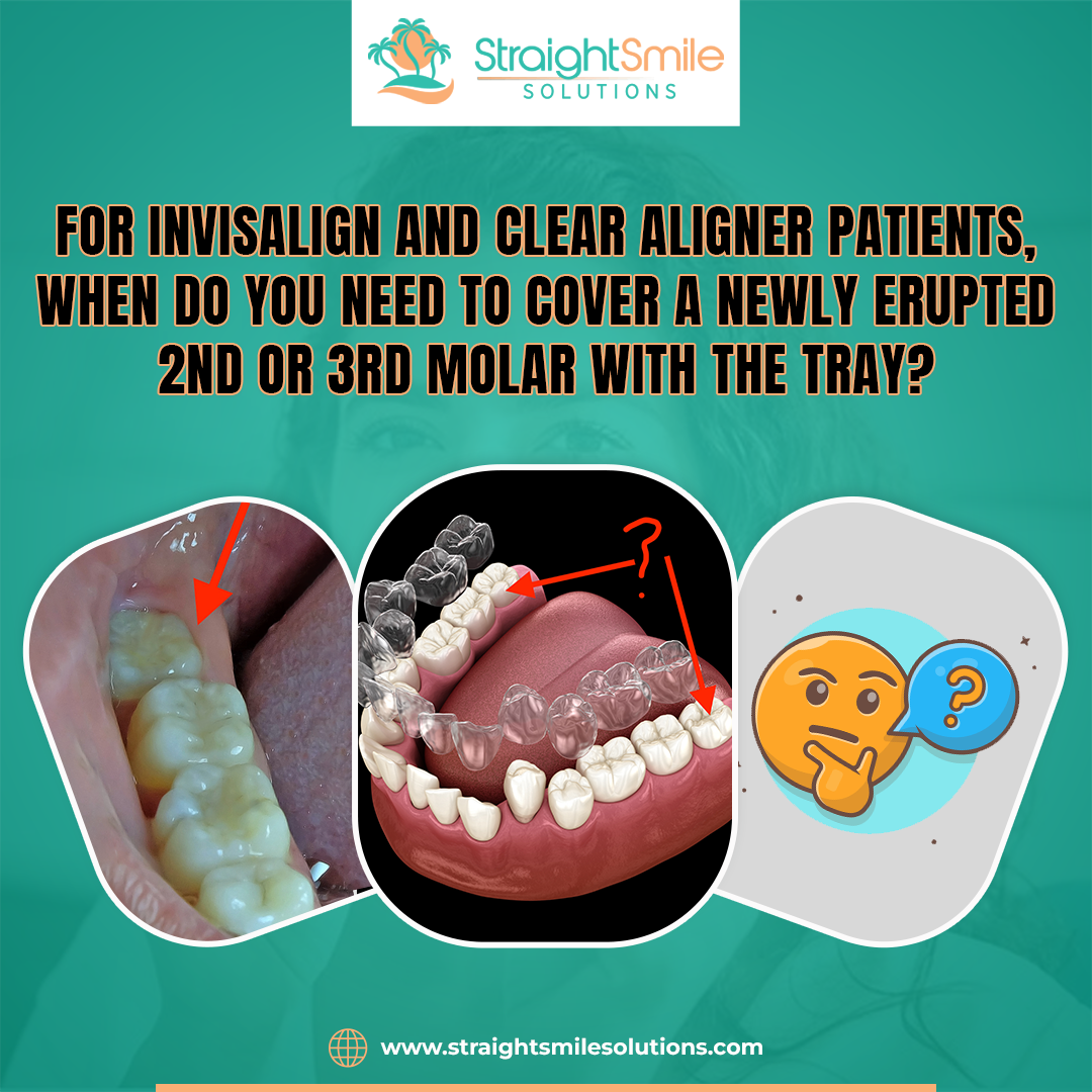 When do you need to cover erupting 2nd or 3rd molars with an invisible ...