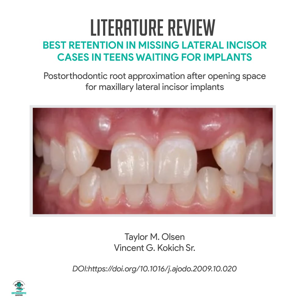 How to Approach Implants in Missing Laterals Cases: Literature Review