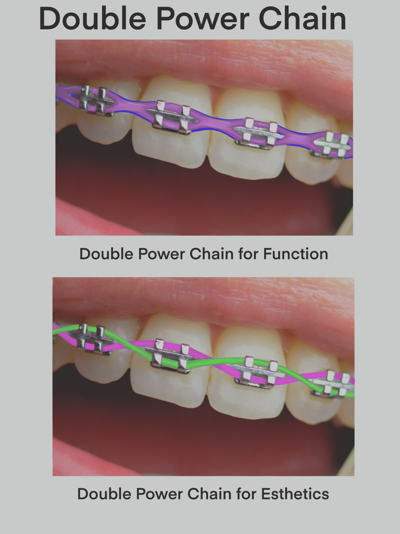 What are the Risks of Double Power Chain?