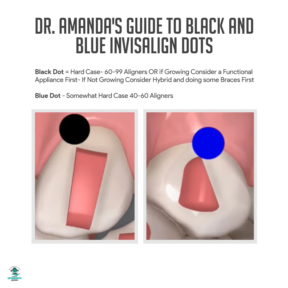 What do Black and Blue Dots Mean in Invisalign?