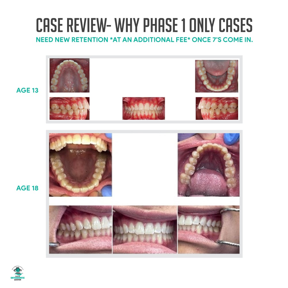 A Phase 1 Case that Didn't Need Phase 2 but DID need new Retainers!