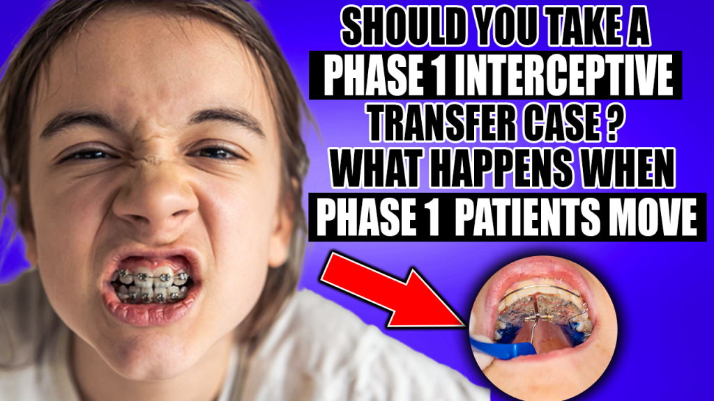 Should You Take a Phase 1 Interceptive Transfer Case?