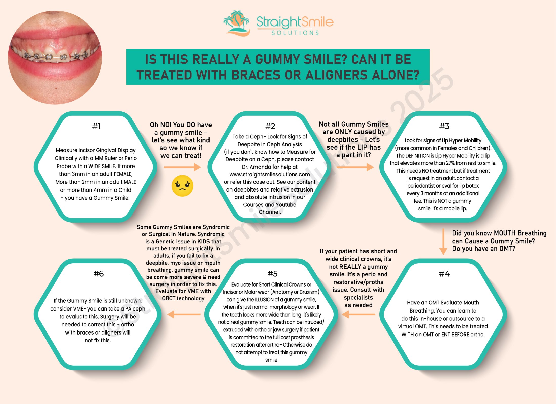 Can this Gummy Smile Be Fixed with Braces or Aligners?