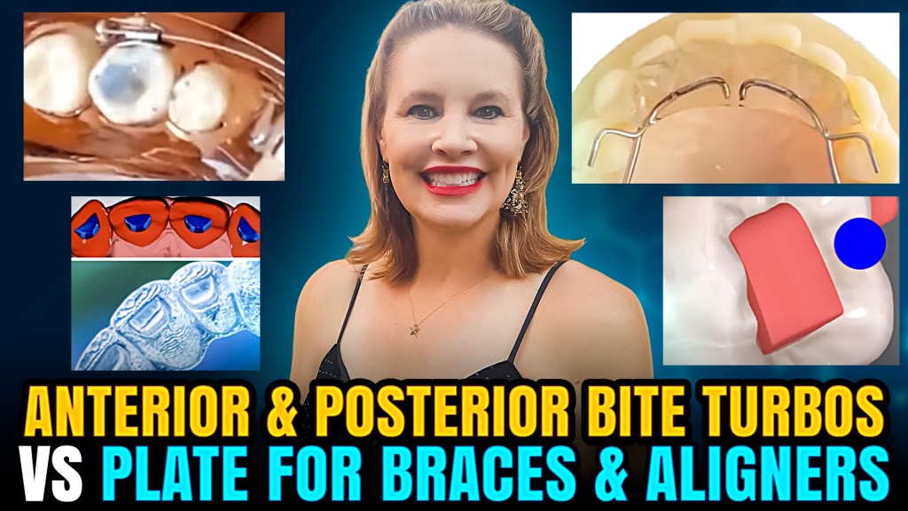 Anterior and Posterior Bite turbos and Plates for Braces And Aligners