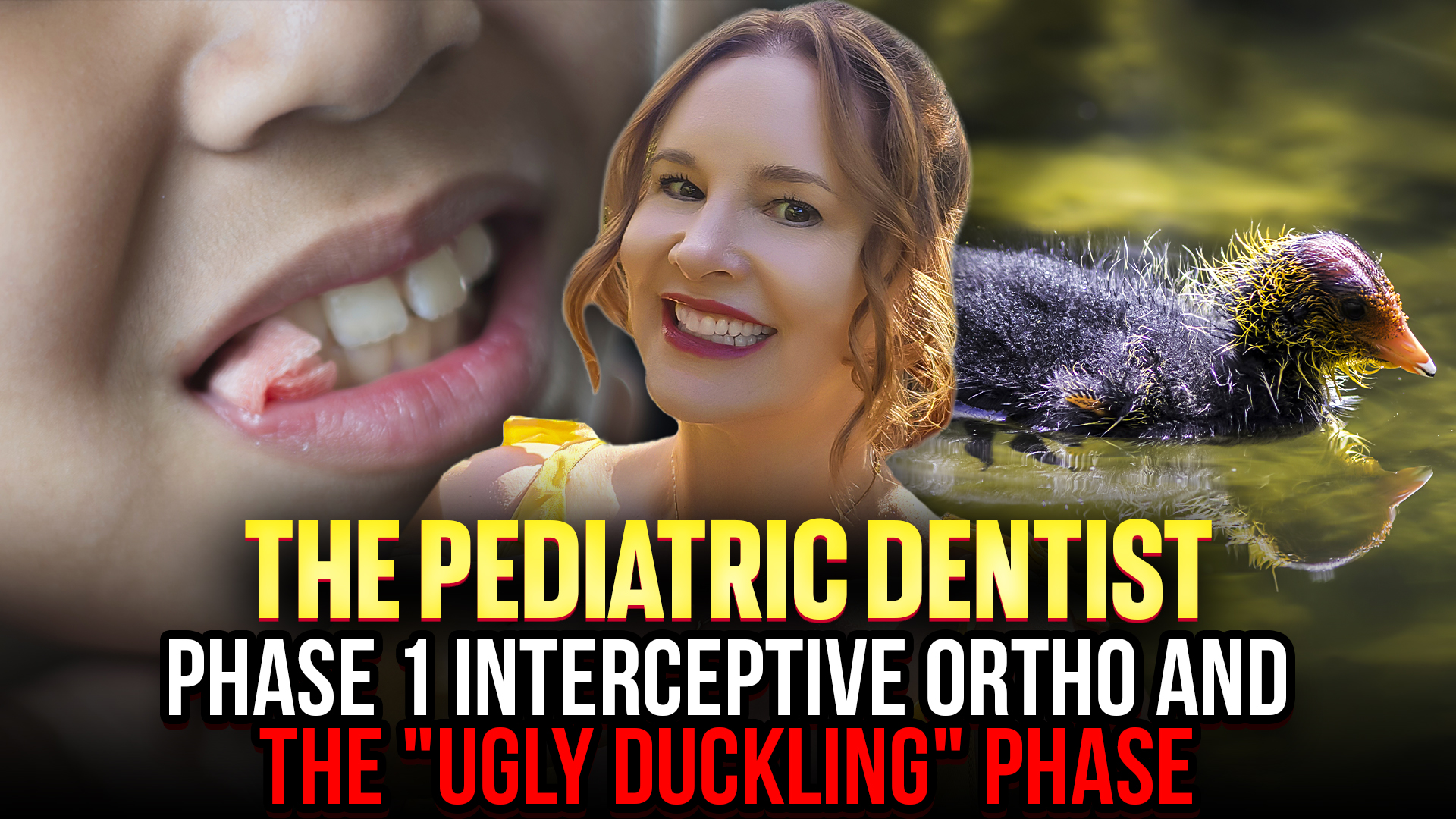 The UGLY DUCKLING PHASE for Pediatric Phase 1 Interceptive Ortho