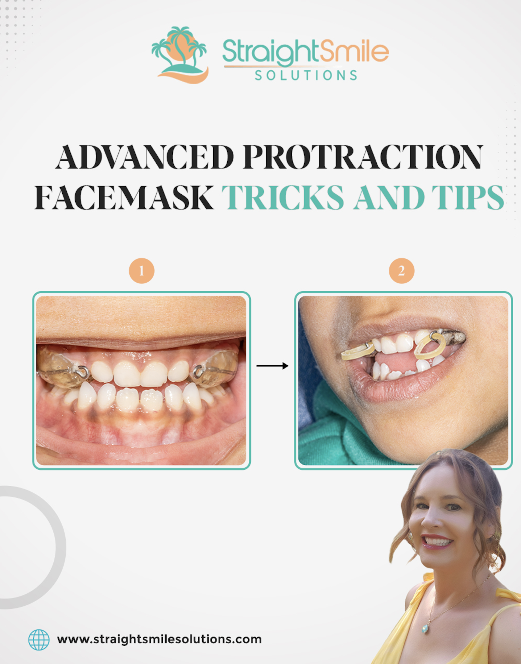 Class 3 Advanced Protraction Facemask Training