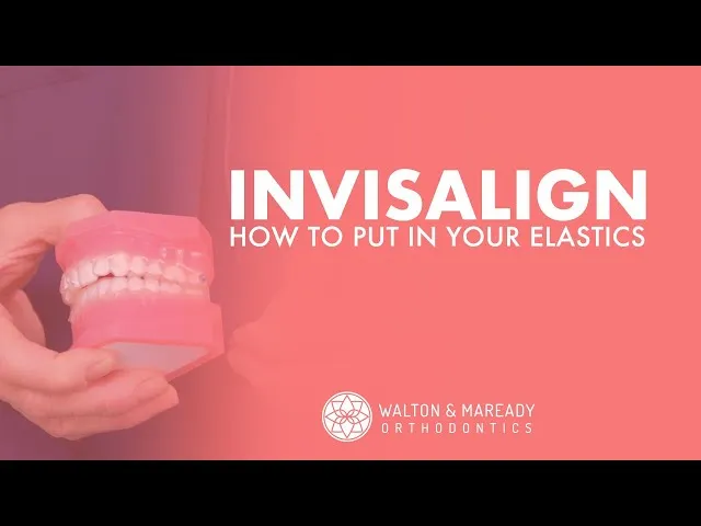 Invisalign and Elastics