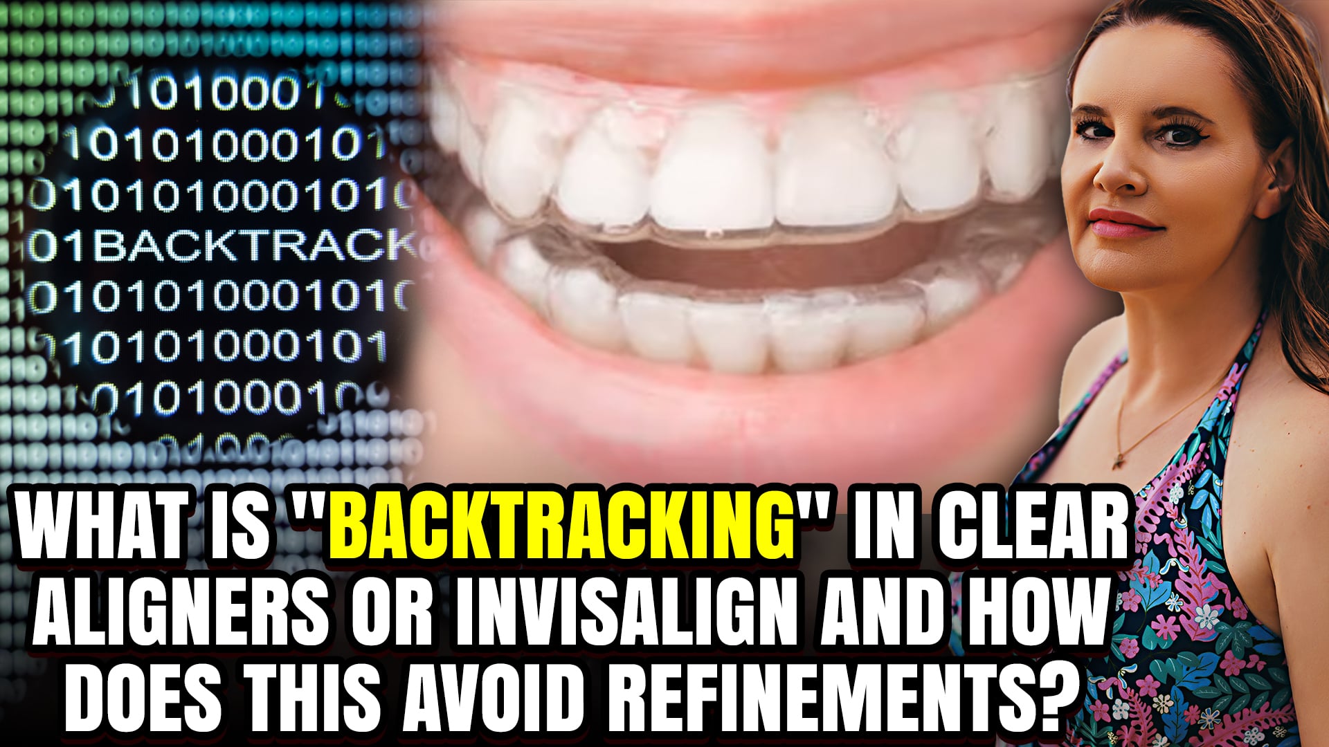 How to Avoid Invisalign and ClearCorrect Refinements with Backtracking