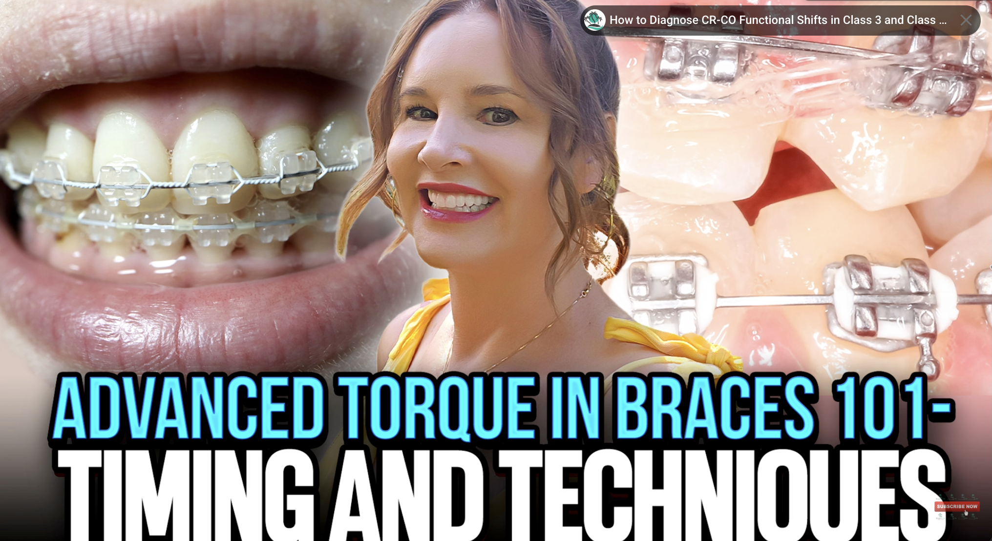Advanced Torque Techniques: Do You Need Special Torquing Wires, Pliers ...